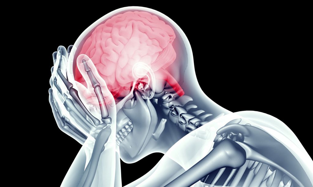 LA PRISE EN CHARGE DE L’AVC – Magazine Thermal